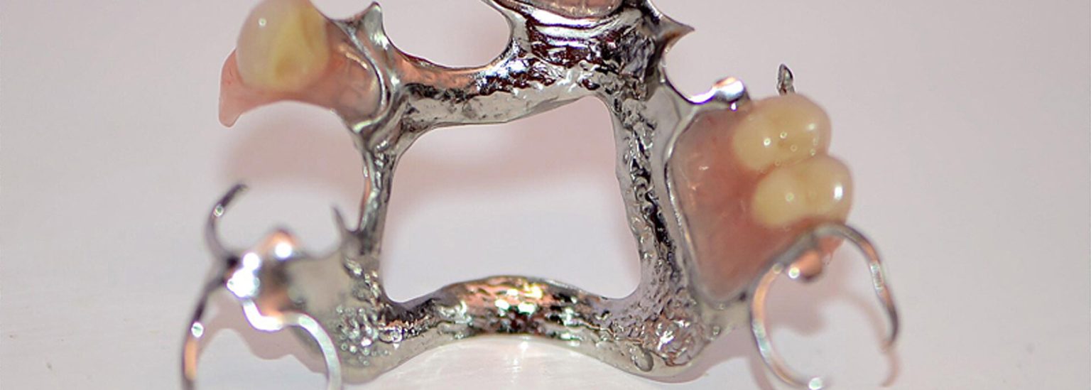 Chrome Framework - Dentures by Jeff