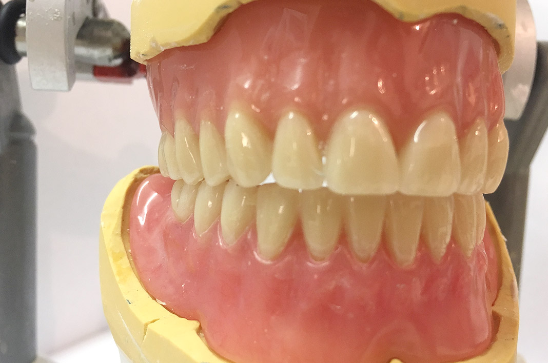 Quality Dentures Sumner Park - Dentures by Jeff